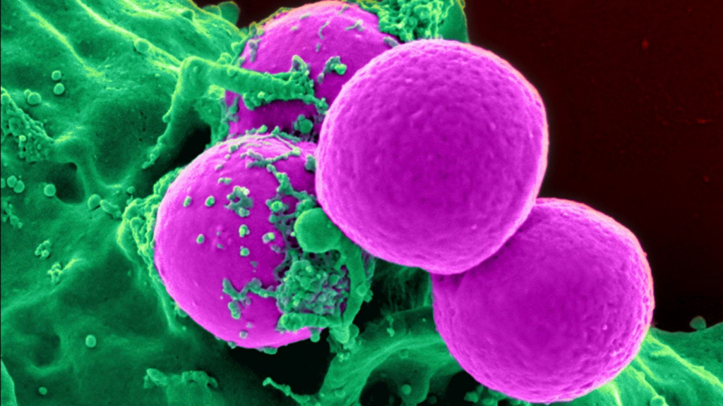 Deinococcus radiodurans - Bathtub Bulletin